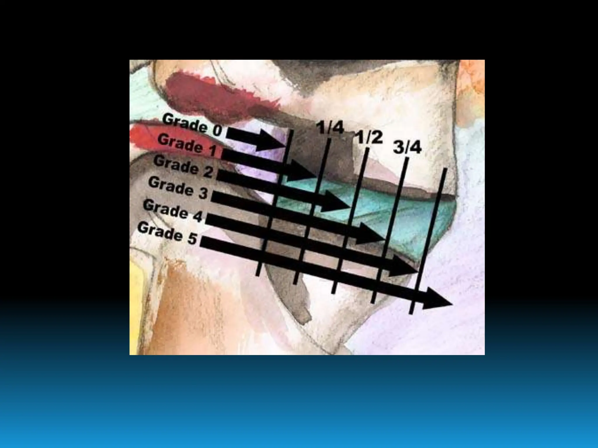 1- spine and brase techniques has specific indications, procedures, and ...