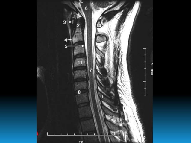 1- spine and brase techniques has specific indications, procedures, and ...