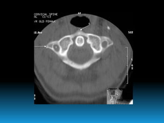 1- spine and brase techniques has specific indications, procedures, and ...