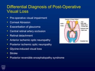 1-Spine Pasternak Mayo.pptx