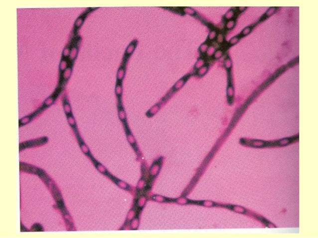 Gram Positive Bacilli List