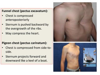 1-Sternum-Osteology- 1 & 2.pdf
