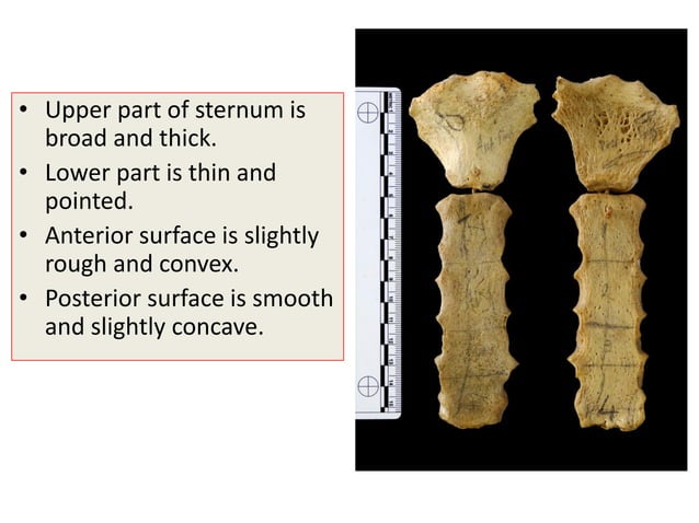 1-Sternum-Osteology- 1 & 2.pdf | Death, Injury, or Military Conflict | Sensitive Topics