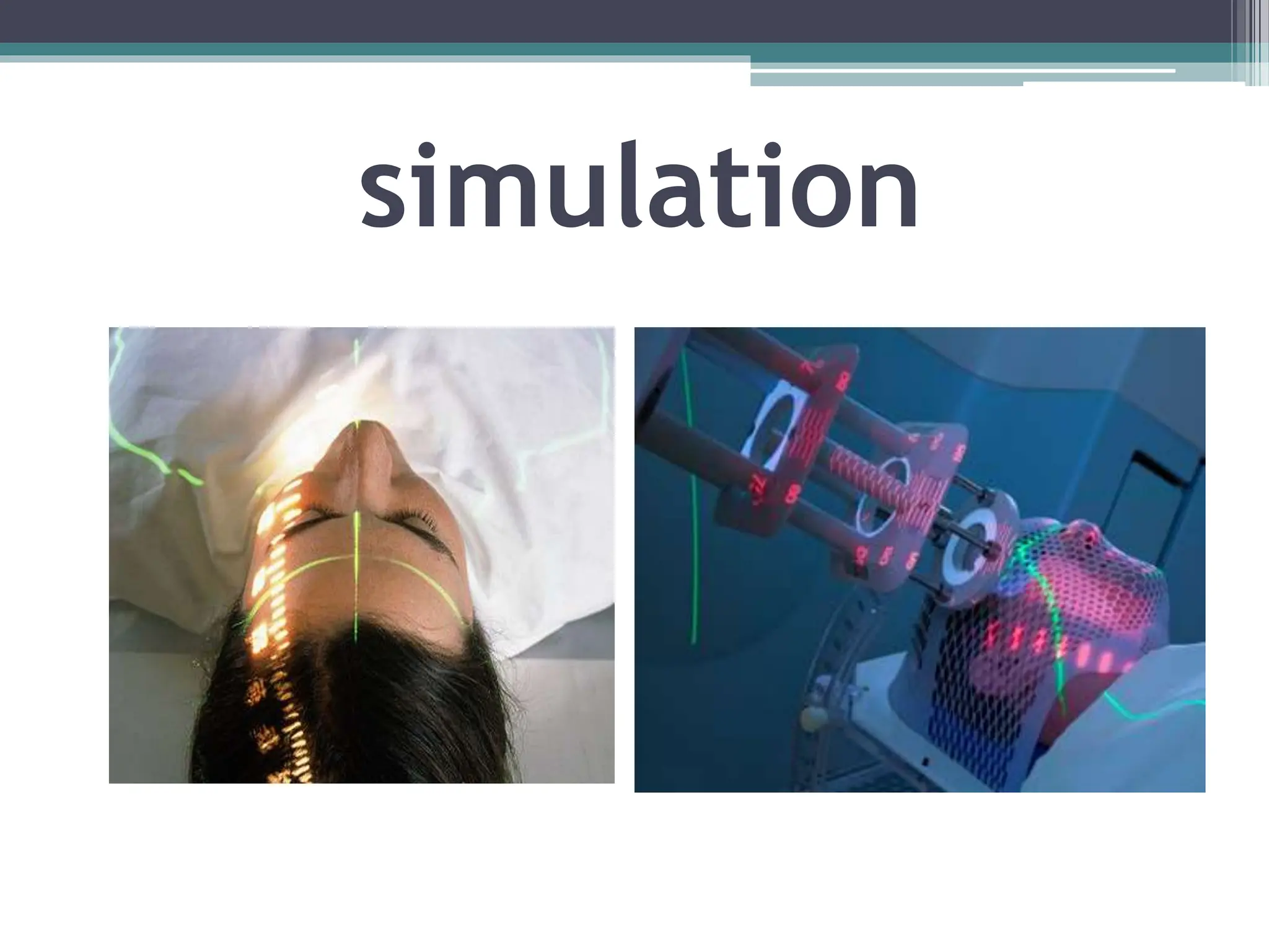 Radiotherapy ppt. Types of radiation and chronic | PPTX