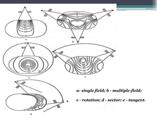 Radiotherapy ppt. Types of radiation and chronic | PPTX