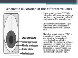Radiotherapy ppt. Types of radiation and chronic | PPTX