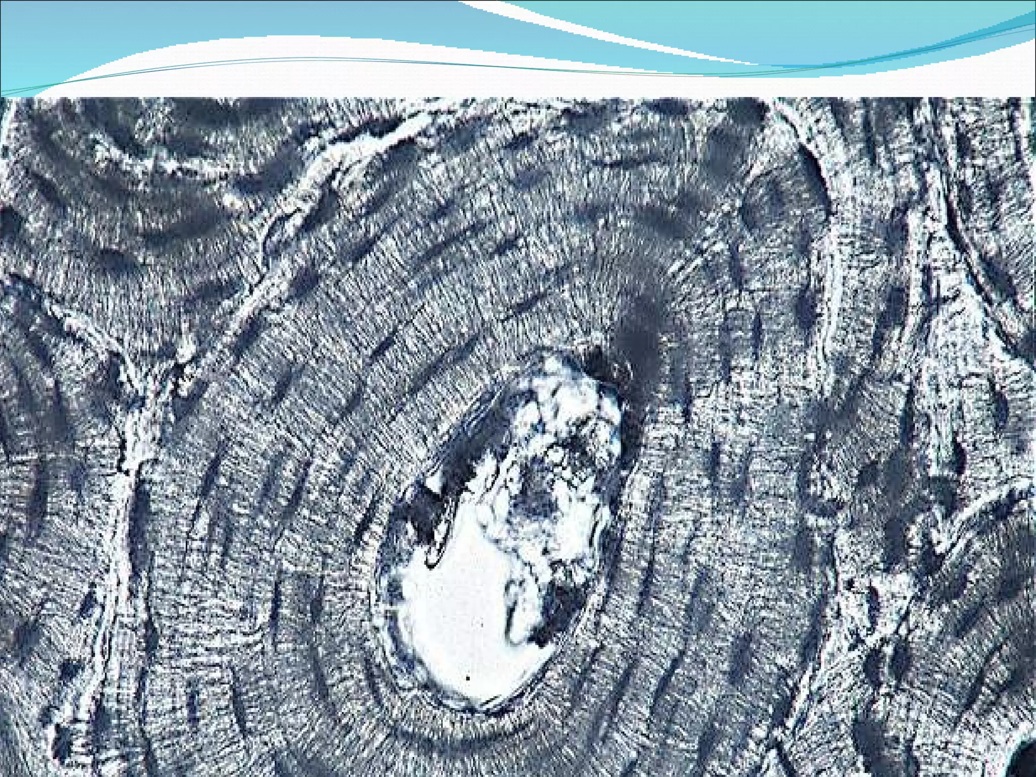 1.structure of bone | PPT