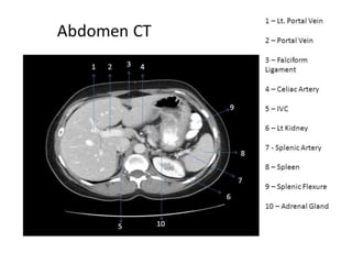 1- Surgical Anatomy of the Retroperitoneal & Pelvic Extraperitoneal ...