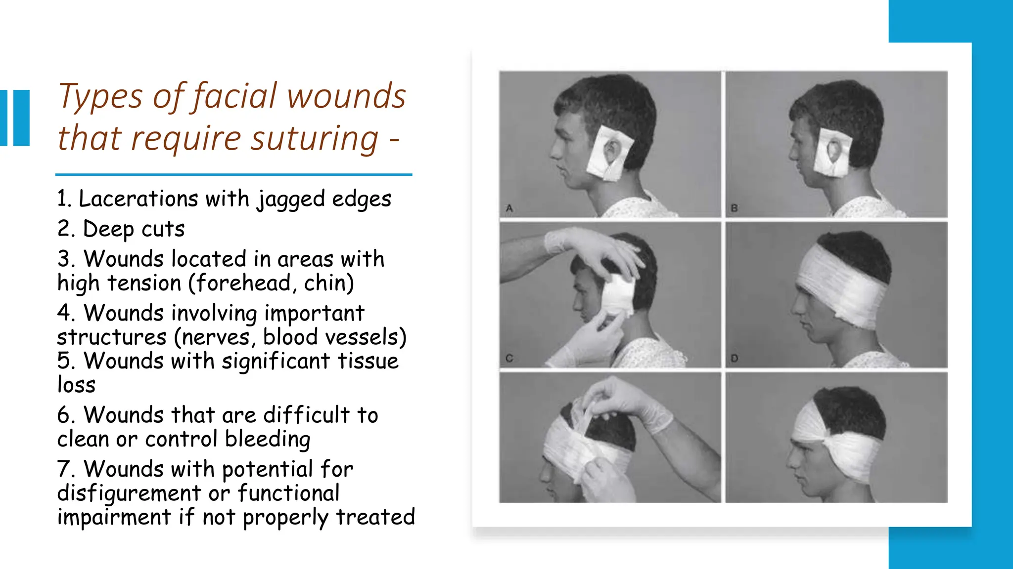 1 - Sutures on facial skin presentation.pptx