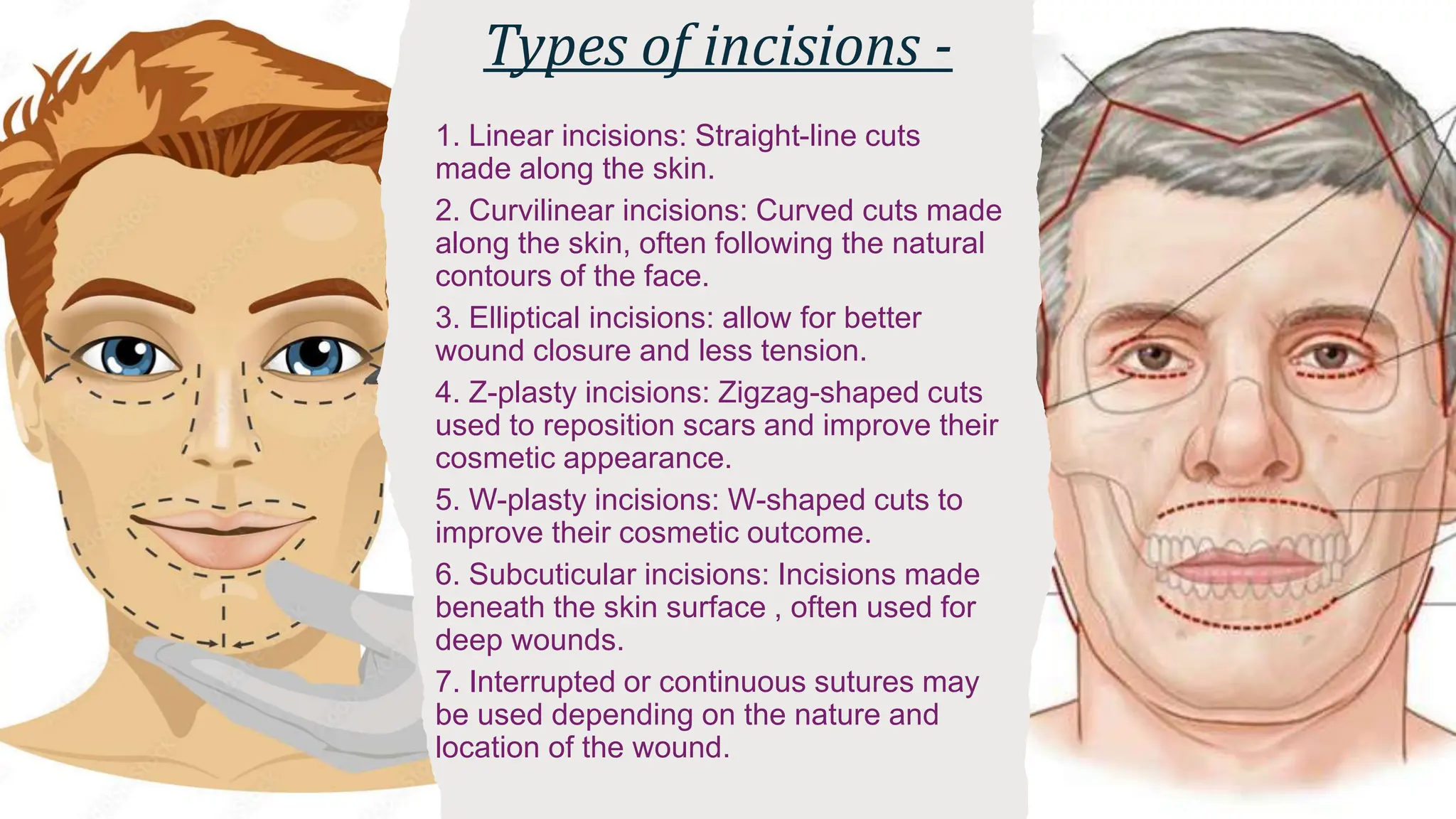 1 - Sutures on facial skin presentation.pptx