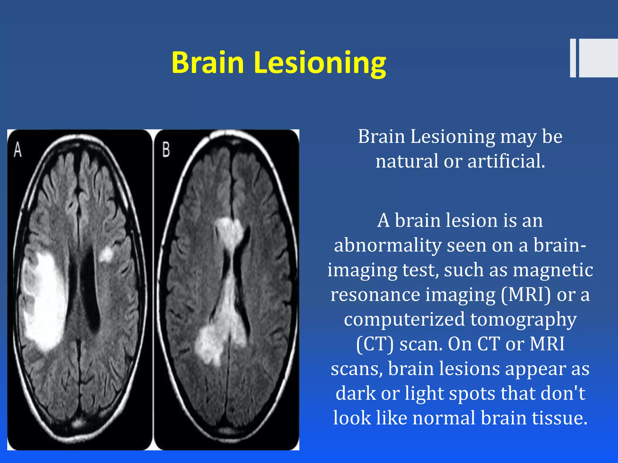Techniques in measuring Brain Function | PPTX