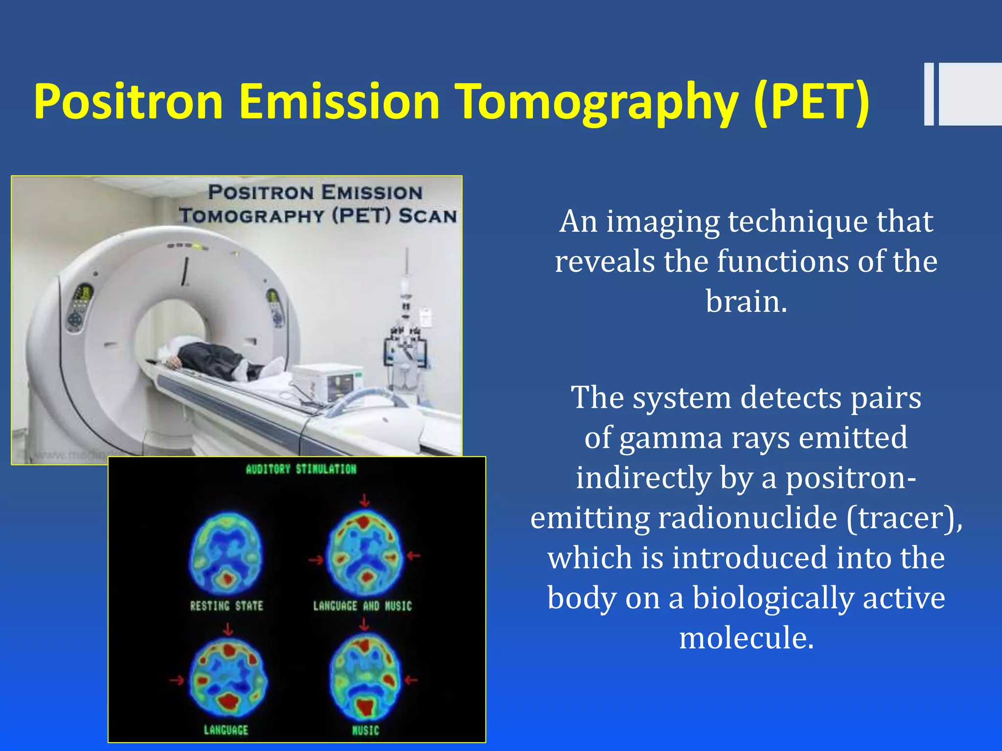 Techniques in measuring Brain Function | PPTX