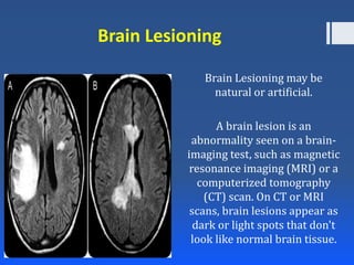 Techniques in measuring Brain Function | PPTX