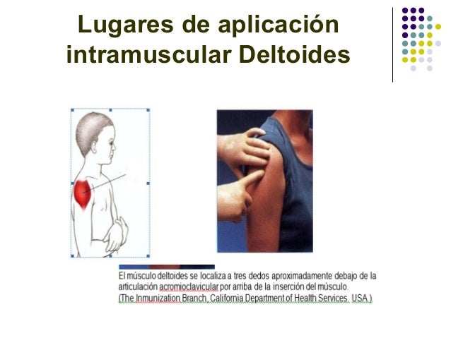 1.técnicas de aplicación Vacunas