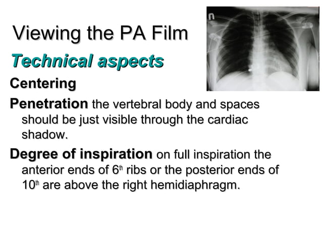 1 the normal cxr | PPT | Free Download