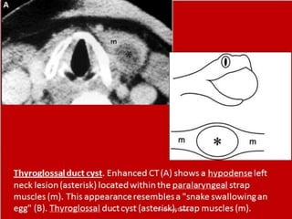 thyriod gland imaging part 1 (radiological anatomy differential ...