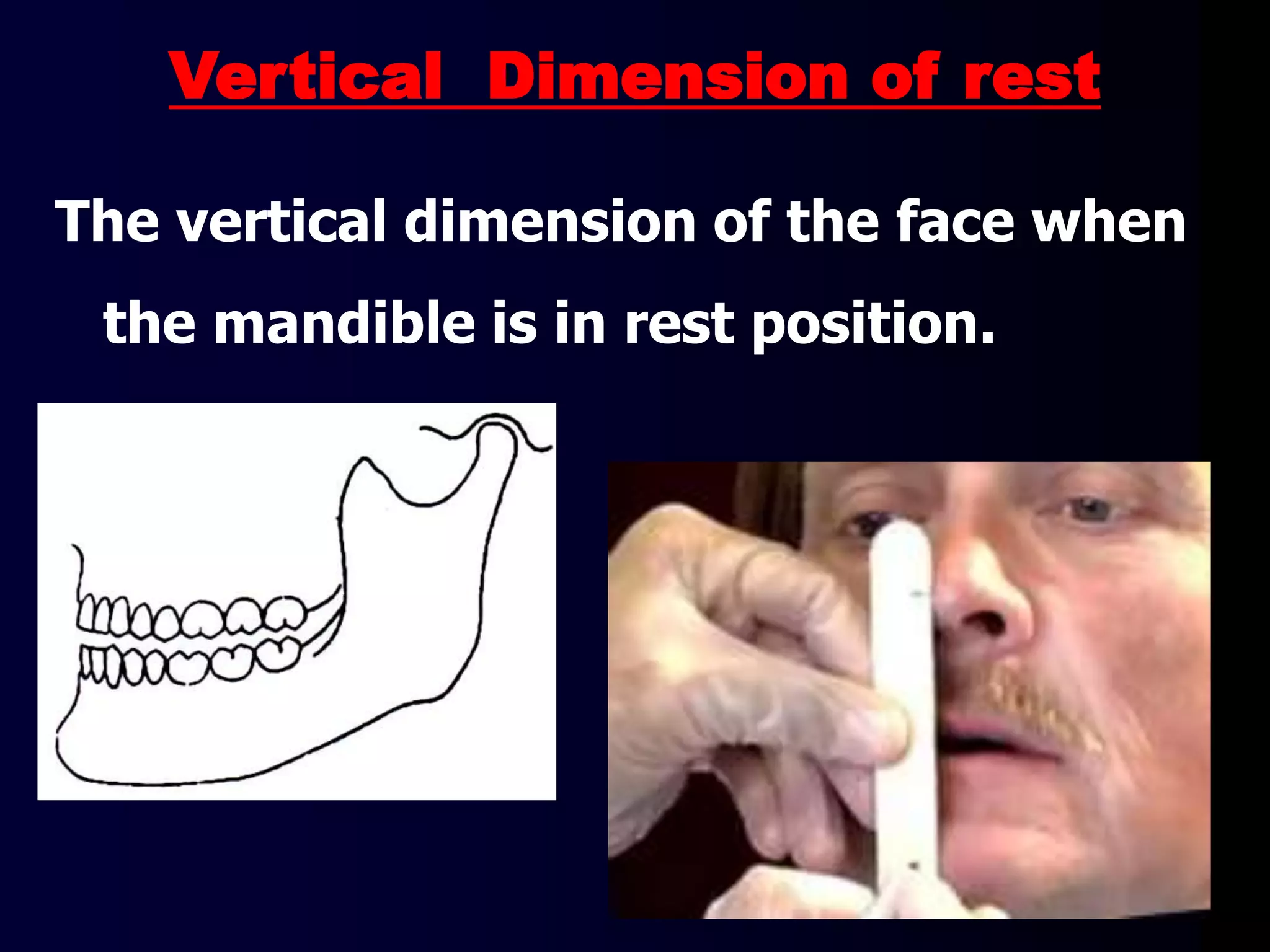 Mandibular movements | PPT