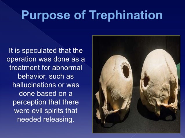 Trephination, Demonology and Exorcism | PPTX | Spirituality | Religion ...