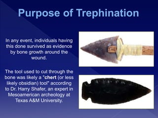 Trephination, Demonology and Exorcism | PPTX