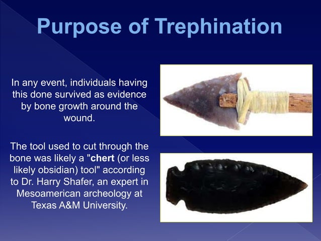Trephination, Demonology and Exorcism | PPTX | Spirituality | Religion ...