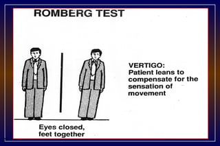 1 vertigo imbalance , balance disorders | PPT