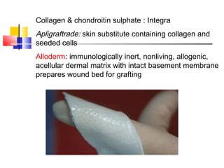 1. wound healing dr. lad | PPT