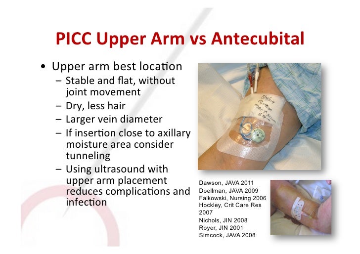 Groshong Catheter Vs Picc Line