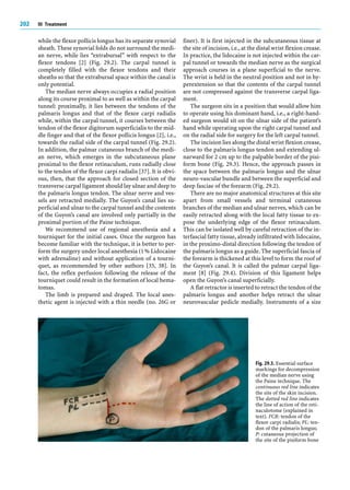 Carpal tunnel syndrome: release with MDC retinaculotome | PDF