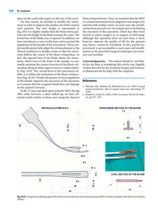Carpal tunnel syndrome: release with MDC retinaculotome | PDF