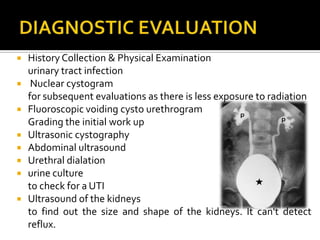 vesicourethral reflux | PPTX