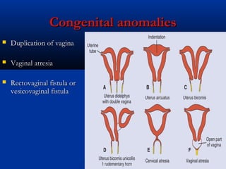 10development Of Urogenital System Ppt
