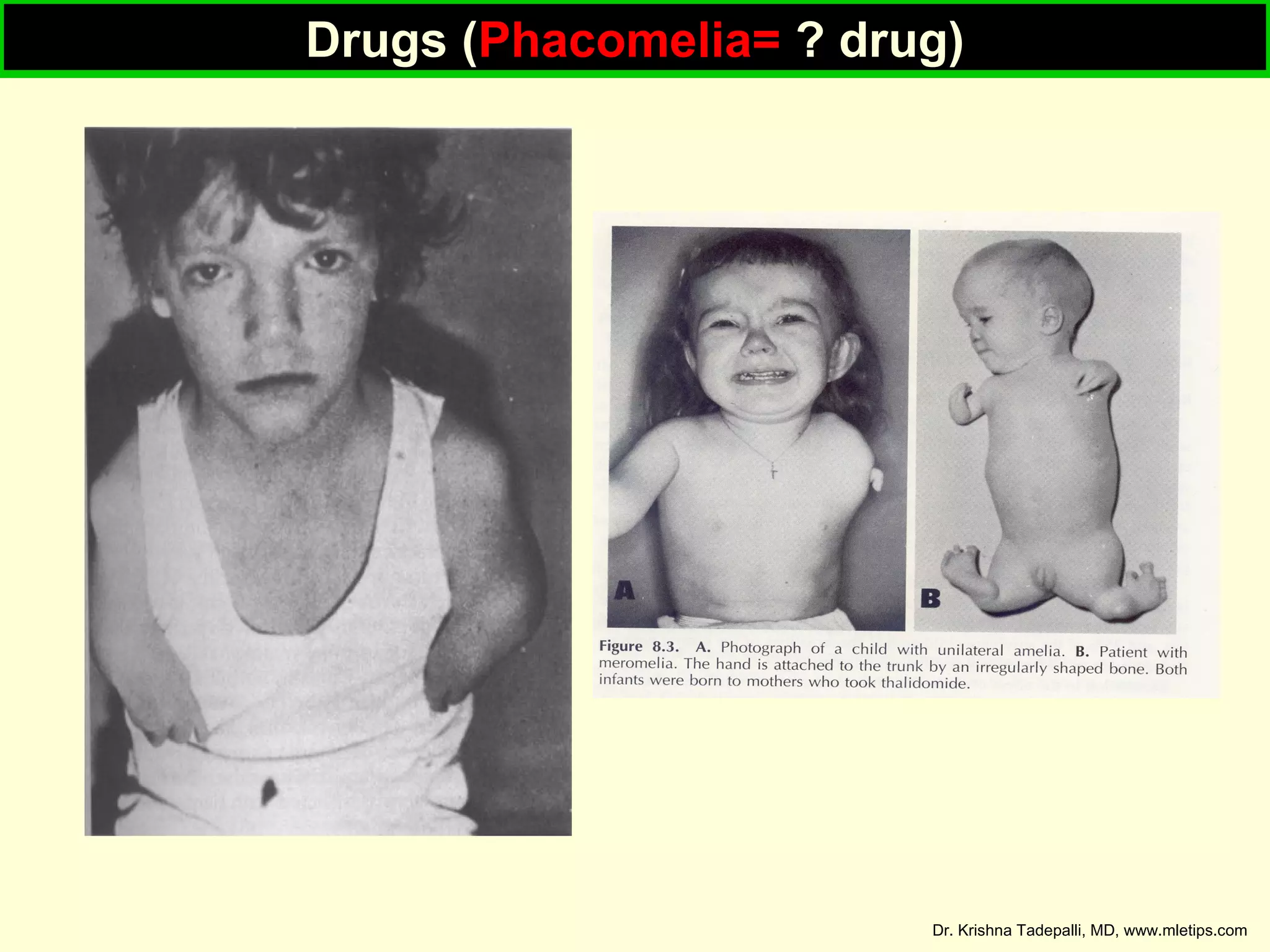 10.1 congenital anomalies; pediatric pathology | PPT