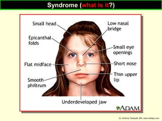 10.1 congenital anomalies; pediatric pathology | PPT