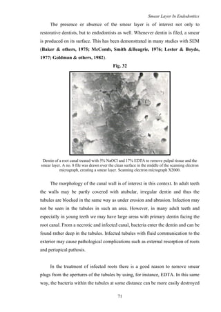smear layer in endodontics/ rotary endodontic courses by indian dental ...
