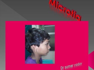 microtia | PPTX