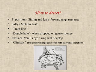 . nasoethmoid complex fractures | PPT