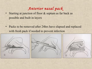 . nasoethmoid complex fractures | PPT