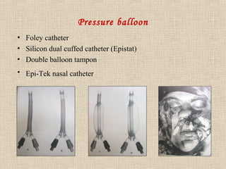 . nasoethmoid complex fractures | PPT