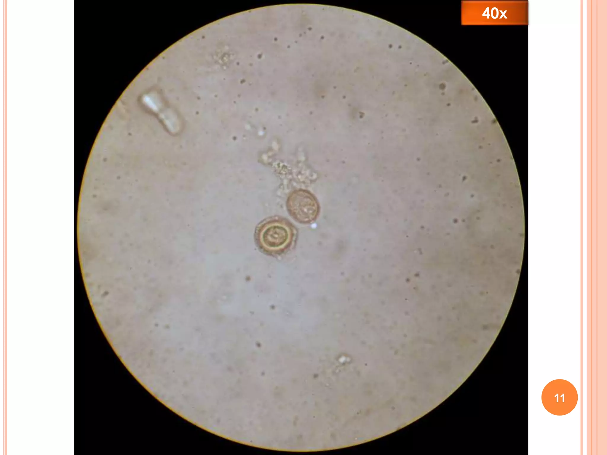 Taenia spp | PPTX