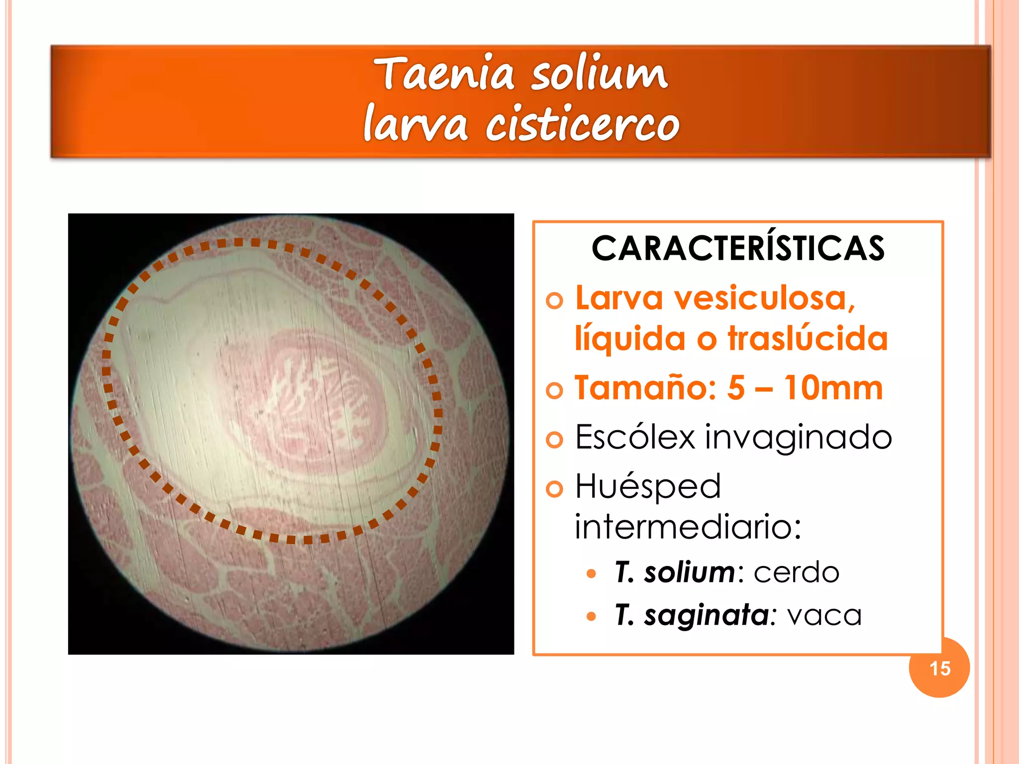 Taenia spp | PPT