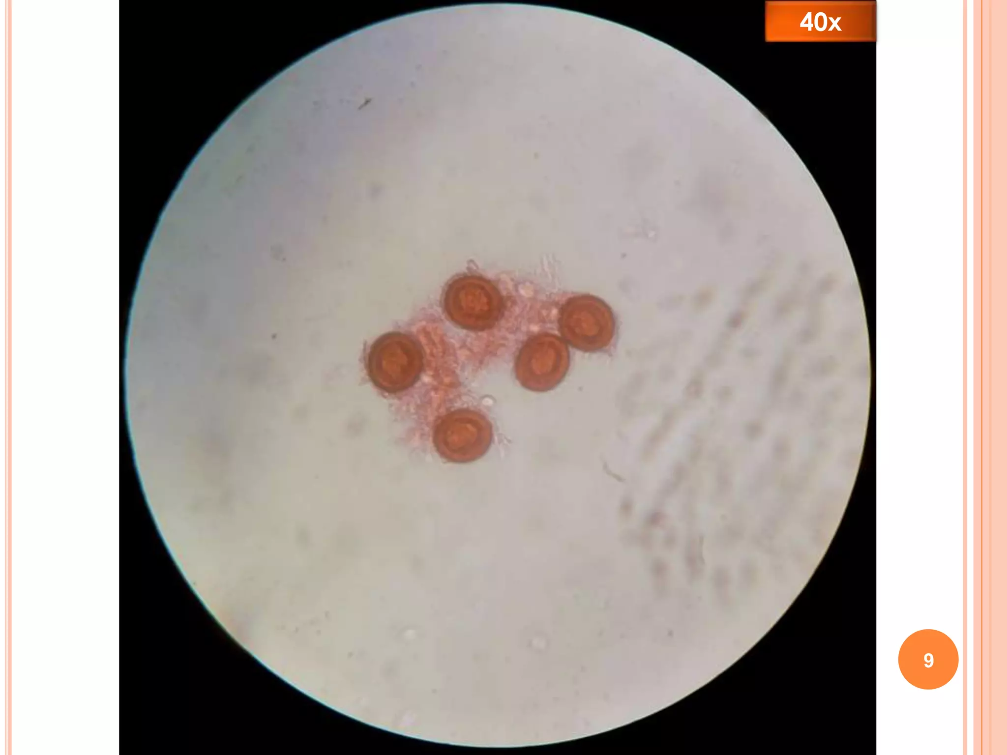 Taenia spp | PPTX