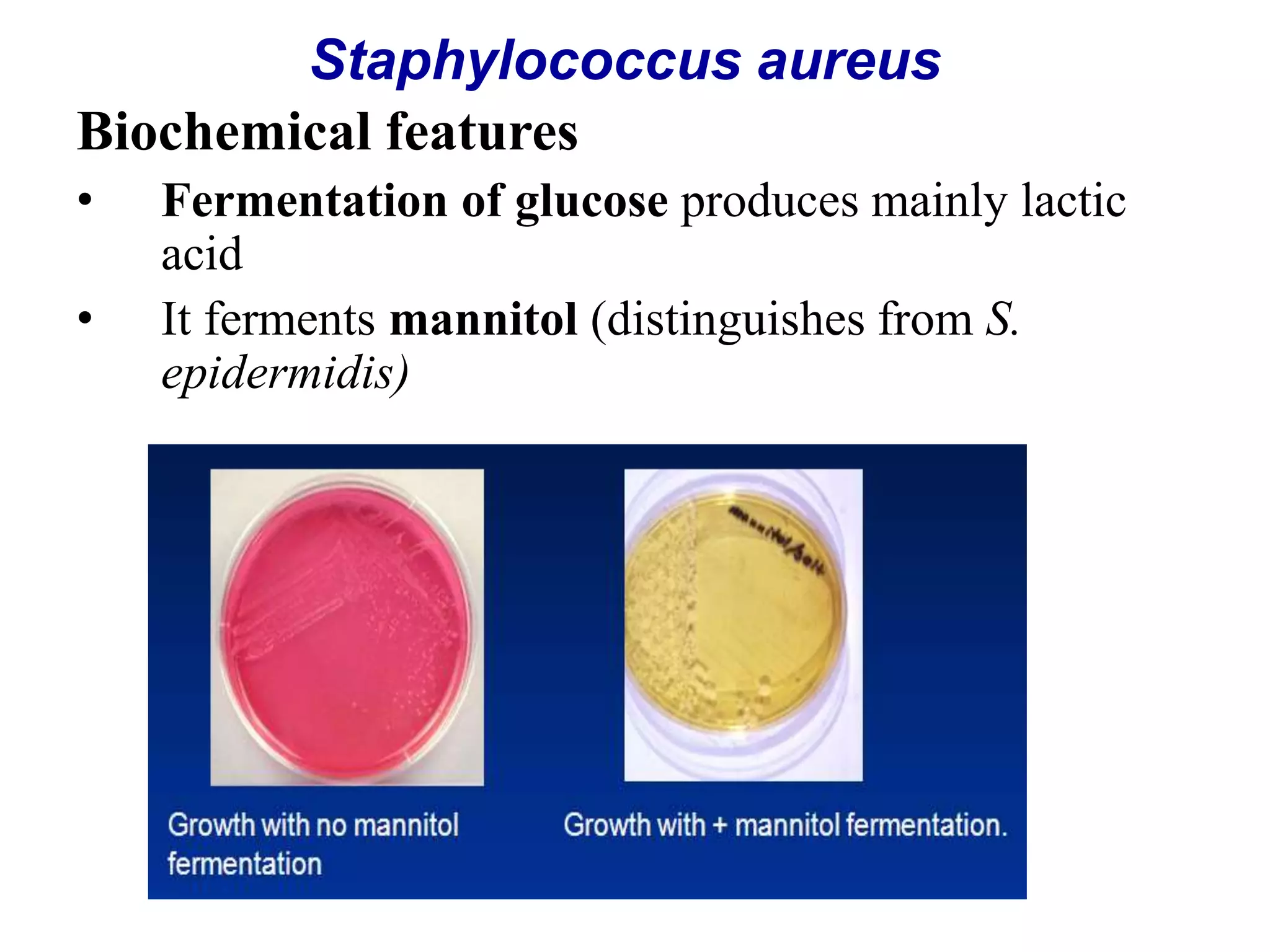 staphylococcus and streptococcus | PPTX | Infectious Diseases ...