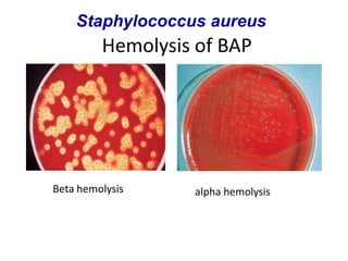 Alpha Hemolytic Staph