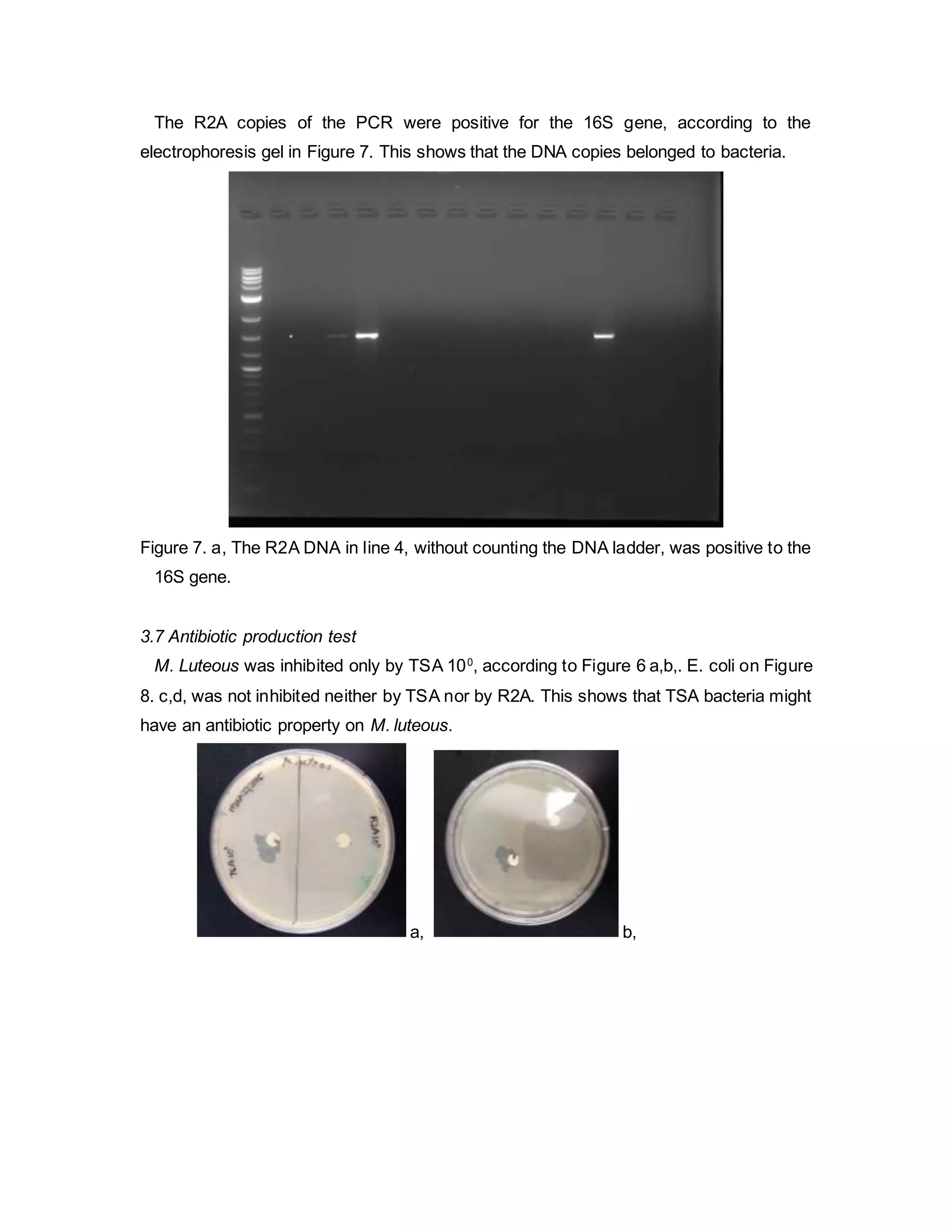 Bacteria Project | DOCX