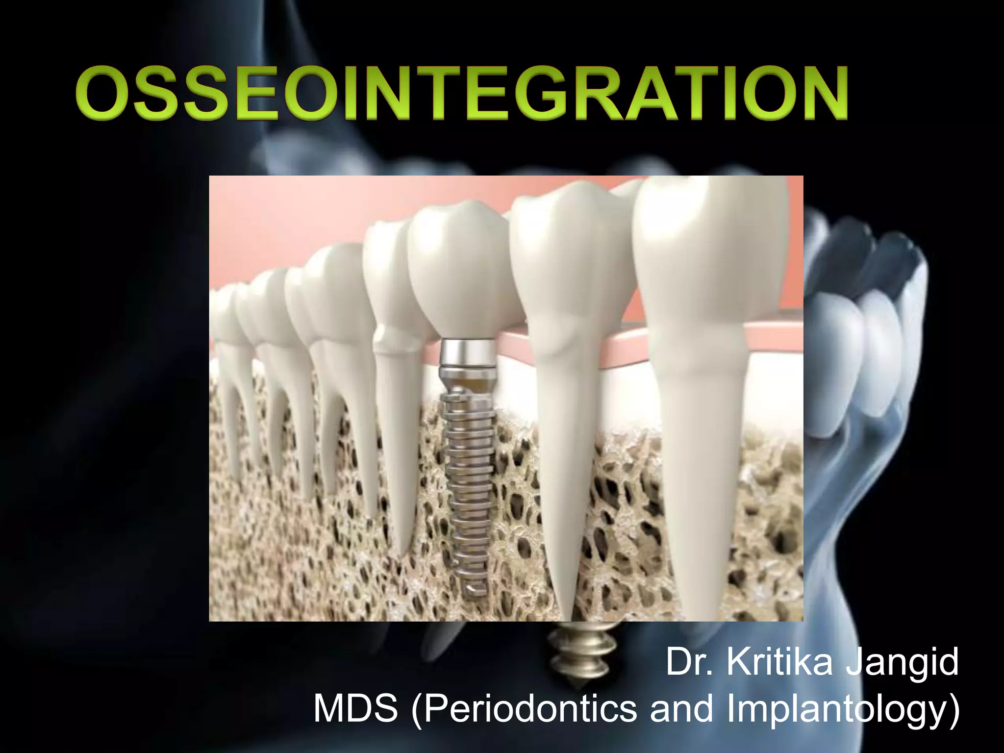 Osseointegration | PPTX