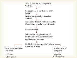 Otosclerosis | PPTX