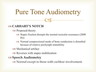 Otosclerosis | PPTX