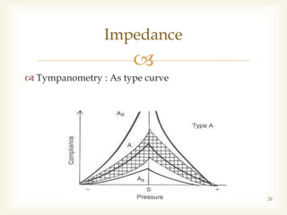 Otosclerosis Tympanogram
