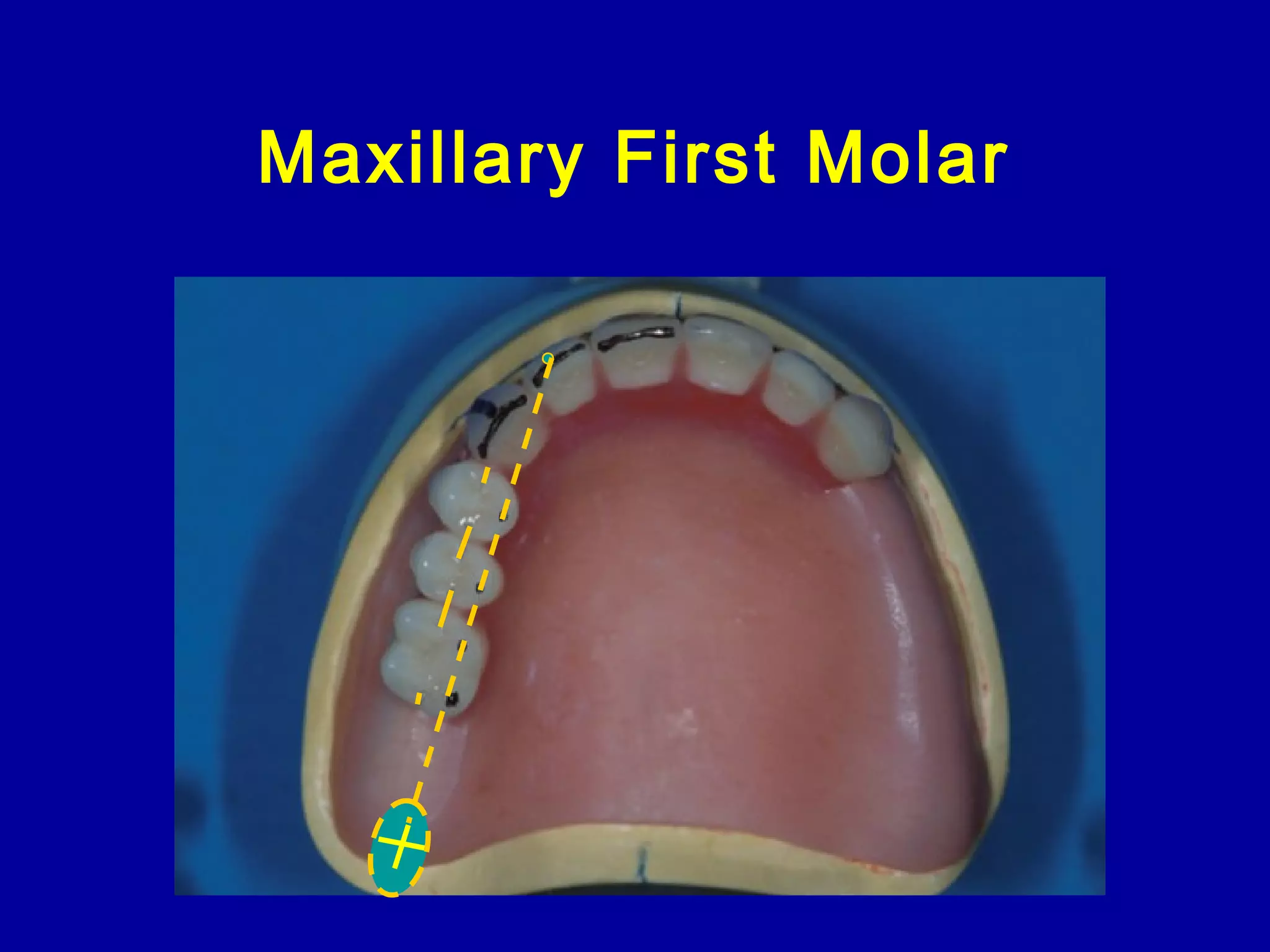 10. posterior teeth arrangement | PPT