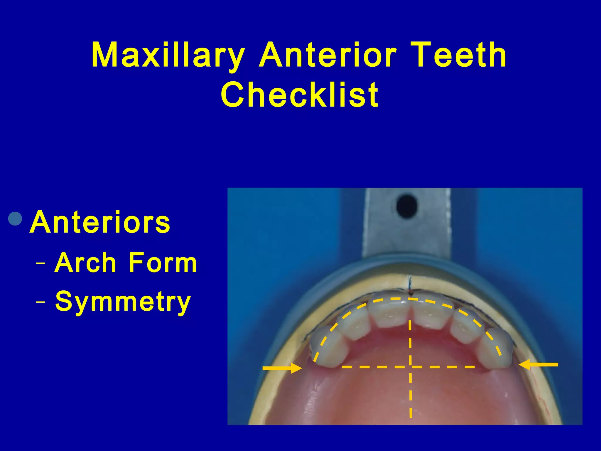 10. posterior teeth arrangement | PPT